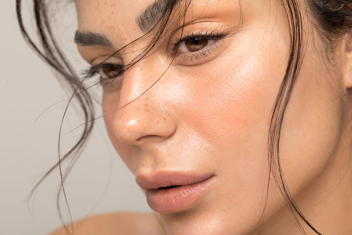 Cheek Fillers in San Antonio, TX | Advanced Aesthetics